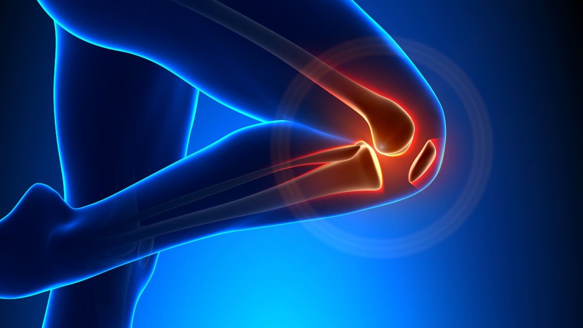 Introducing the Icarus Hercules KAFO